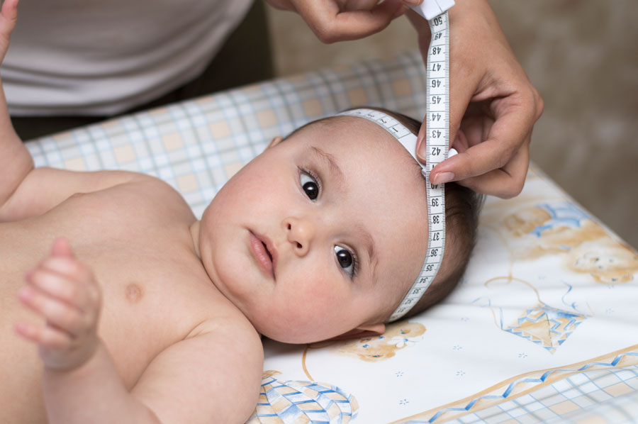 Microcefalia - Blog Hospital Pilar